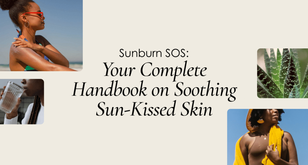 Sunburn SOS: Your Complete Handbook on Soothing Sun-Kissed Skin | Black ...